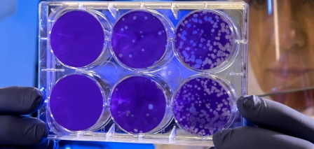 Actualizada la normativa sobre Legionella: Cambios y repercusiones en ...